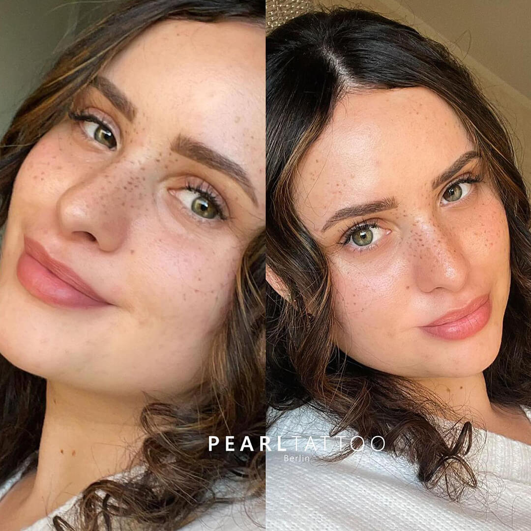 How to pigment Freckles Tattoos - Pigmentation Academy